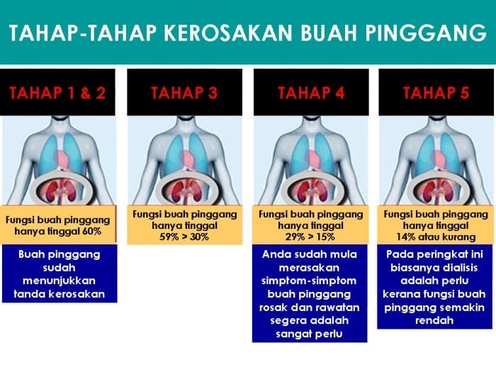 Menyingkap Perbedaan Pinggang Dan Pinggul: Faktor, Kesehatan, Dan ...